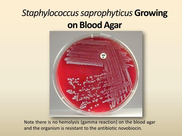 PPT - Isolation and Identification of Staphylococci PowerPoint ...