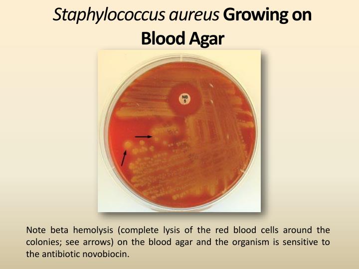 PPT - Isolation and Identification of Staphylococci PowerPoint ...