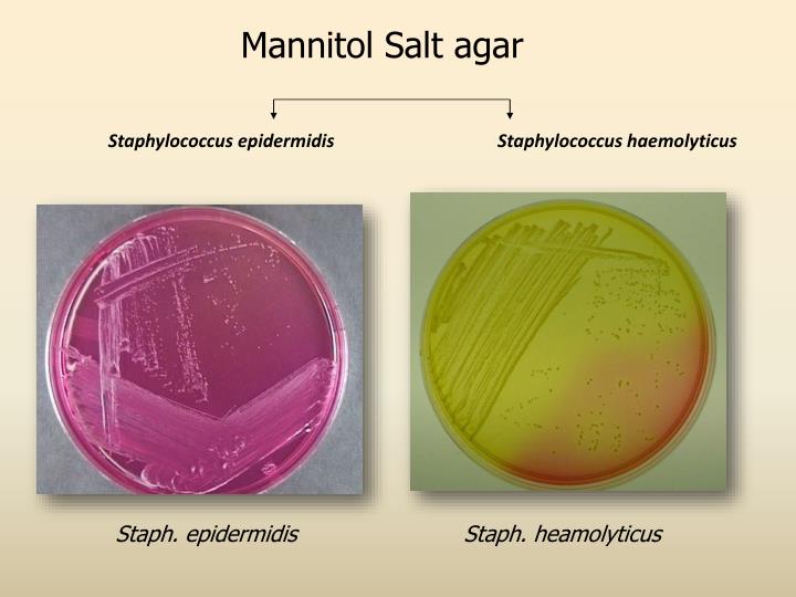 PPT - Isolation and Identification of Staphylococci PowerPoint ...