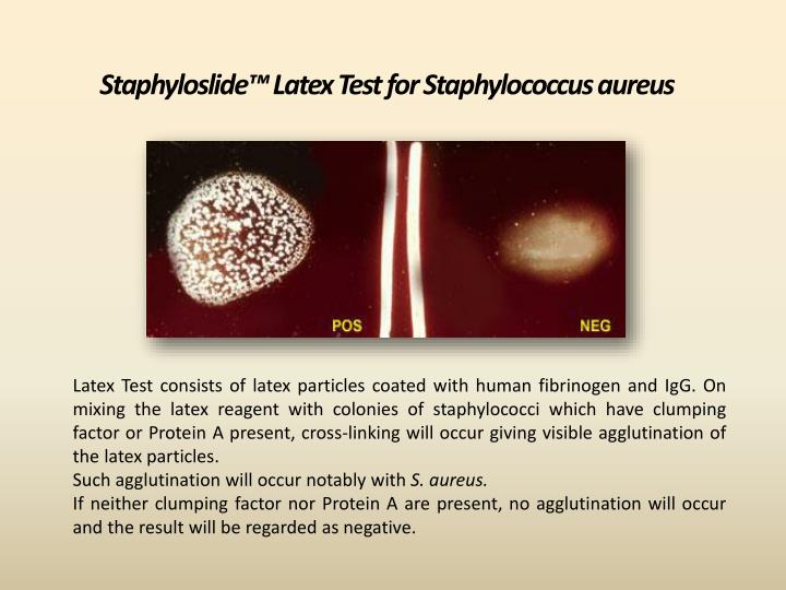 PPT - Isolation and Identification of Staphylococci PowerPoint ...
