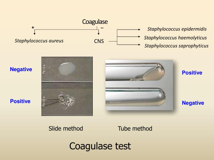 PPT - Isolation and Identification of Staphylococci PowerPoint ...
