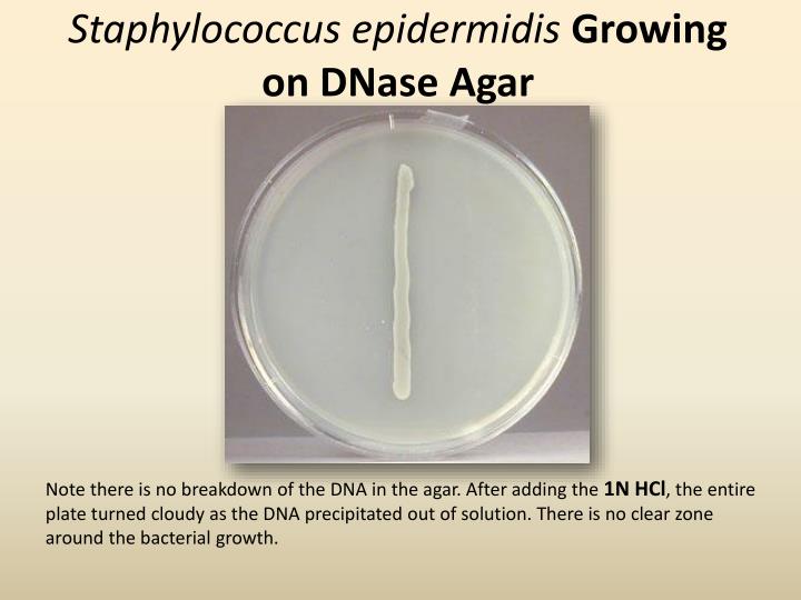 PPT - Isolation and Identification of Staphylococci PowerPoint ...