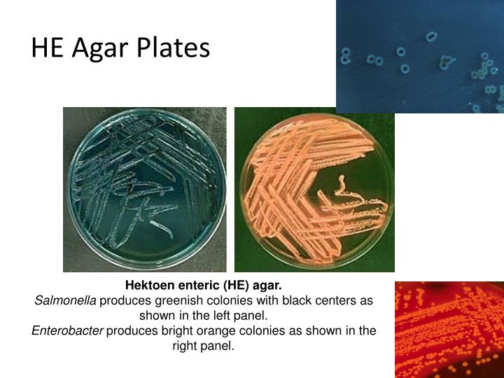 PPT - Selective and Differential Media PowerPoint Presentation - ID:6207891