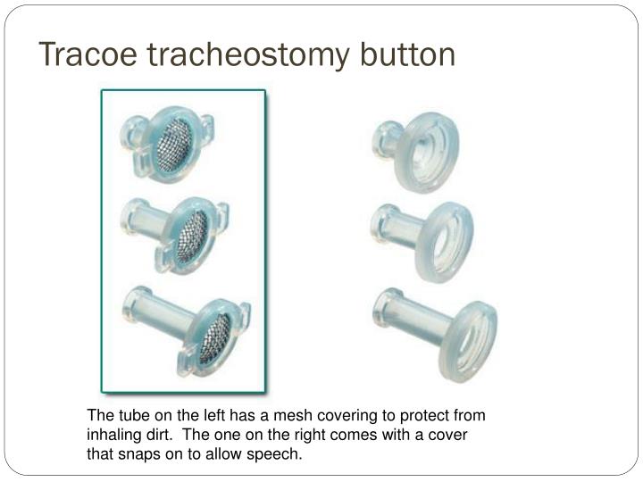 PPT - What Kind of Tube is This?! PowerPoint Presentation - ID:6215268