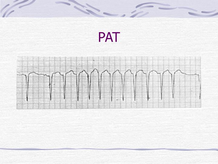 PPT - Basic EKG Interpretation PowerPoint Presentation - ID:6221328