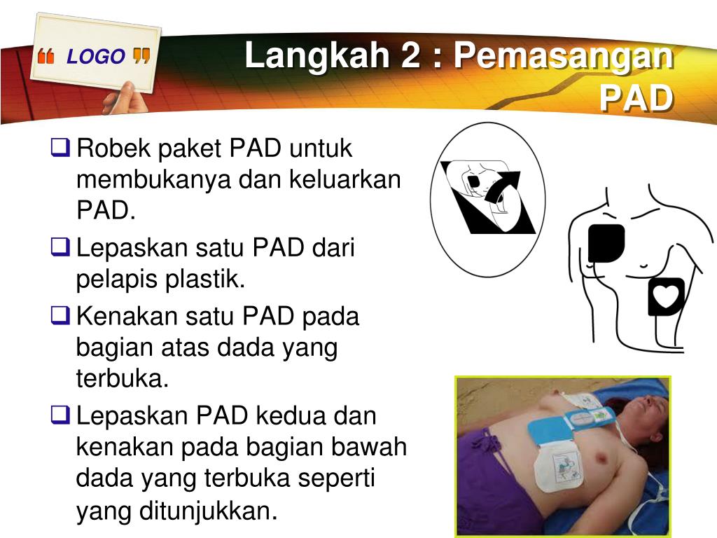 PPT - Cara Penggunaan AED ( Automated External De fibrillator ) pada ...