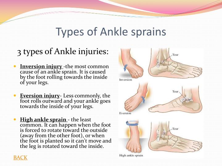 PPT - Ankle Injuries PowerPoint Presentation - ID:6224785 PPT - Ankle Injuries PowerPoint Presentation - ID:6224785