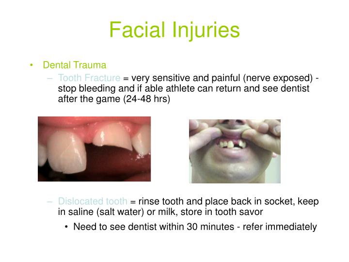 PPT - Head and Face Injuries PowerPoint Presentation - ID:6226363