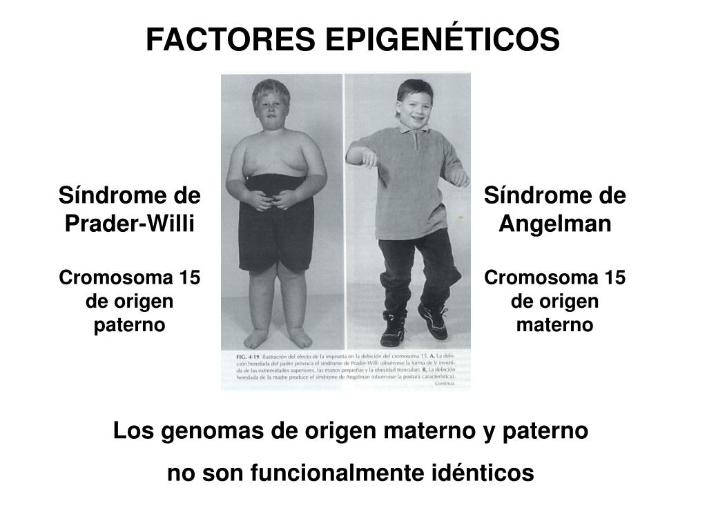 PPT - Deformidad de la mano hendida (70% penetrancia) PowerPoint ...