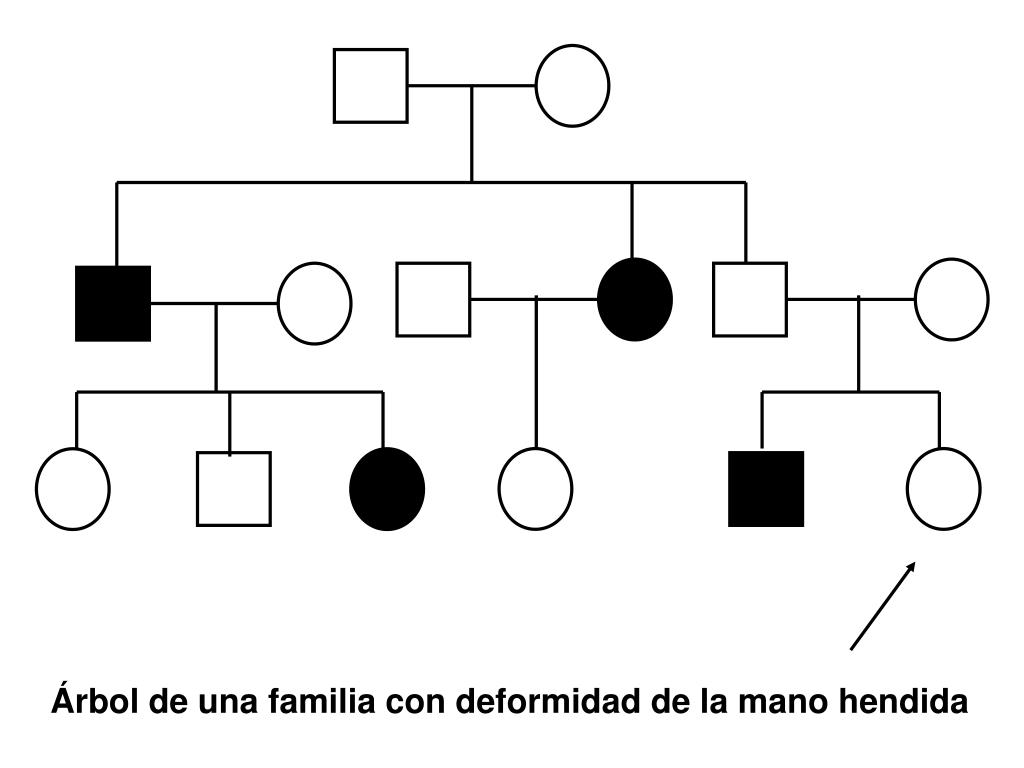 PPT - Deformidad de la mano hendida (70% penetrancia) PowerPoint ...