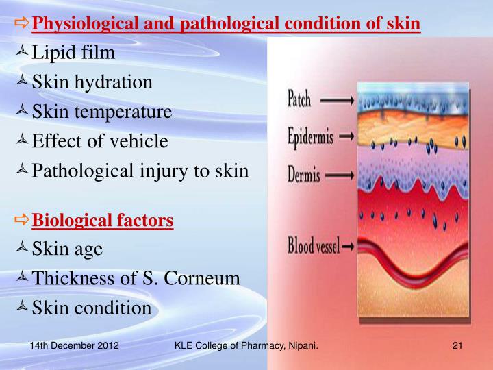 PPT - TRANSDERMAL DRUG DELIVERY SYSTEM PowerPoint Presentation - ID:6240594
