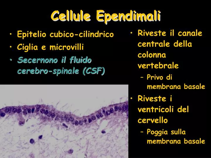 PPT - Cellule Ependimali PowerPoint Presentation, free download - ID ...