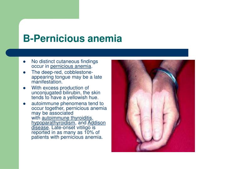 PPT - Dermatologic manifestation of haematologic diseases PowerPoint ...