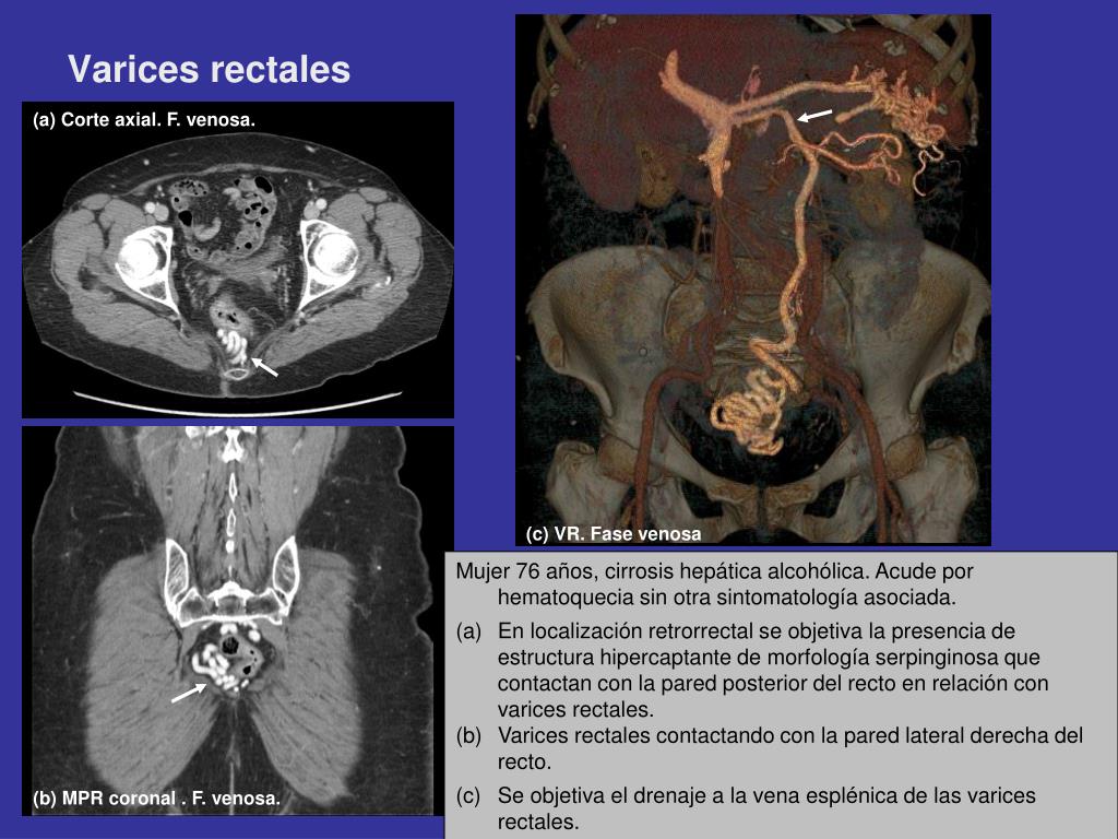 PPT - Existen distintas técnicas para determinar el origen de la ...