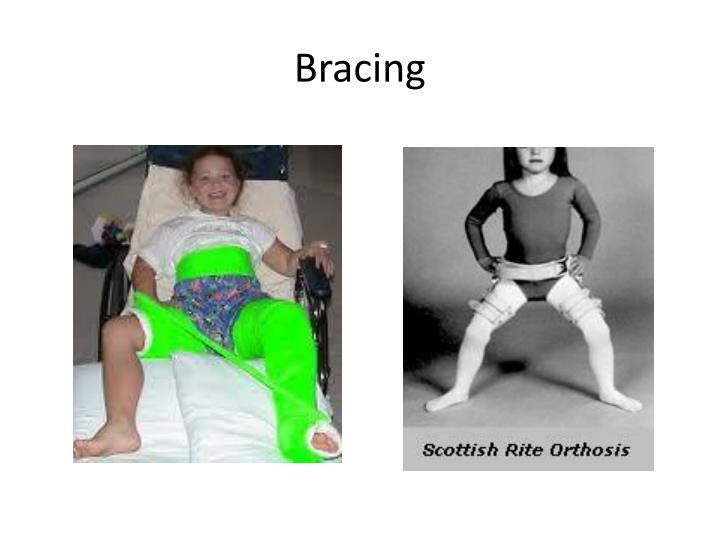 PPT - Legg- Calve – Perthes disease PowerPoint Presentation - ID:6258406