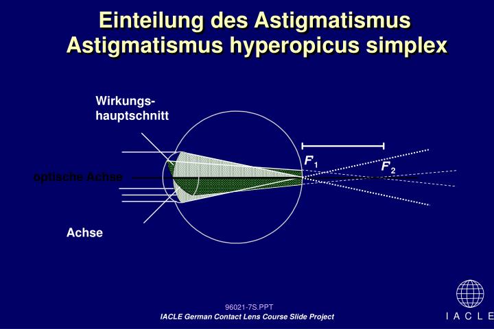 PPT - Astigmatismus PowerPoint Presentation - ID:6260765