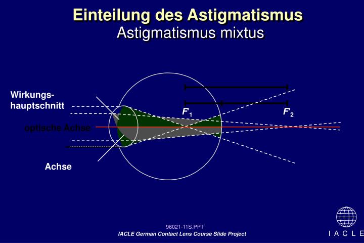 PPT - Astigmatismus PowerPoint Presentation - ID:6260765