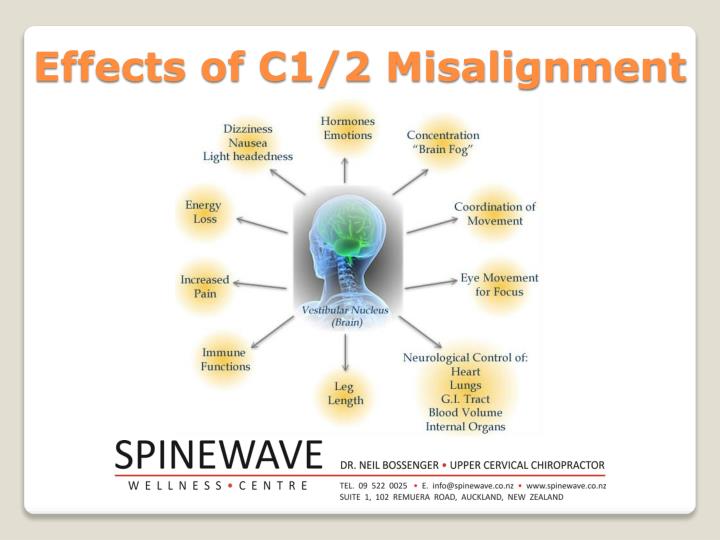 PPT - The Power of Upper Cervical PowerPoint Presentation - ID:6266118