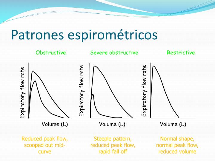PPT - Taller de Espirometría PowerPoint Presentation - ID:6274327