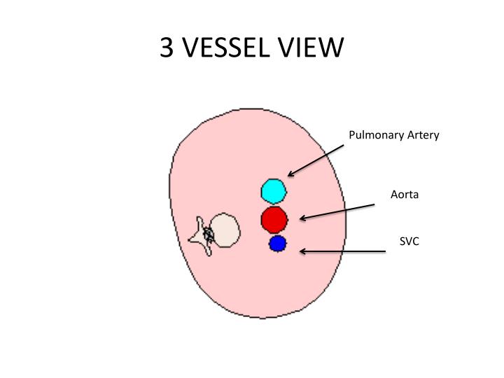 PPT - Fetal Heart Project PowerPoint Presentation - ID:6274427