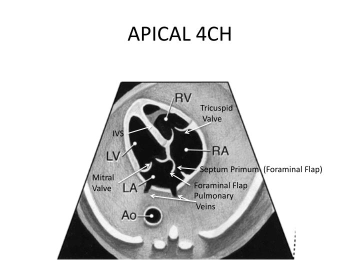 PPT - Fetal Heart Project PowerPoint Presentation - ID:6274427