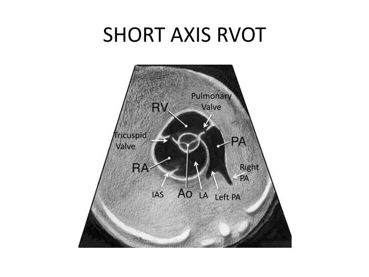 PPT - Fetal Heart Project PowerPoint Presentation - ID:6274427