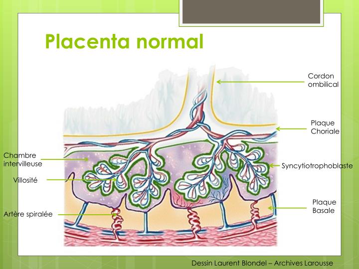 PPT - Nouvelles Pathologies du Placenta L’intervillite Histiocytaire ...