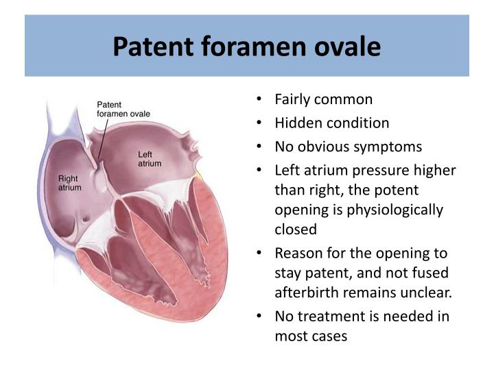 PPT - The Heart PowerPoint Presentation - ID:6299761