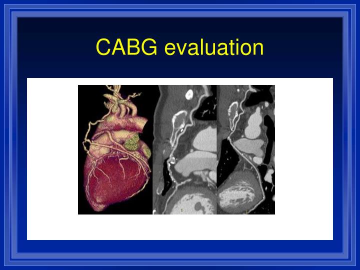PPT - CARDIAC CT SCANNING PowerPoint Presentation - ID:6303170