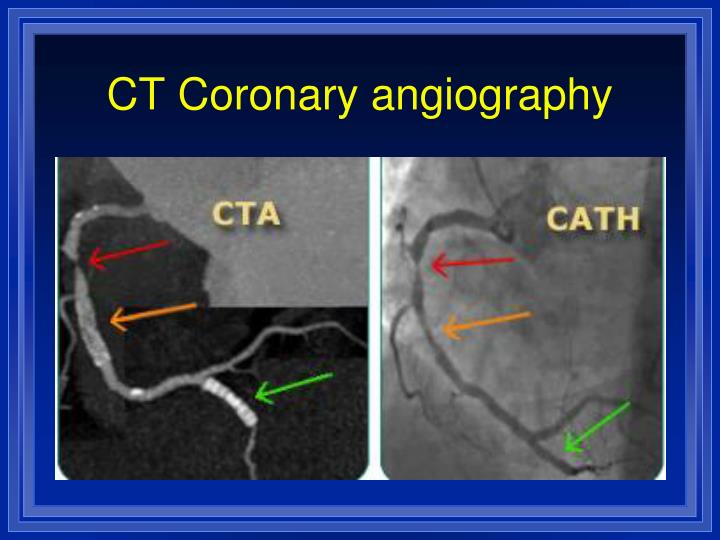 PPT - CARDIAC CT SCANNING PowerPoint Presentation - ID:6303170