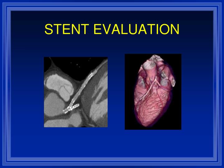 PPT - CARDIAC CT SCANNING PowerPoint Presentation - ID:6303170