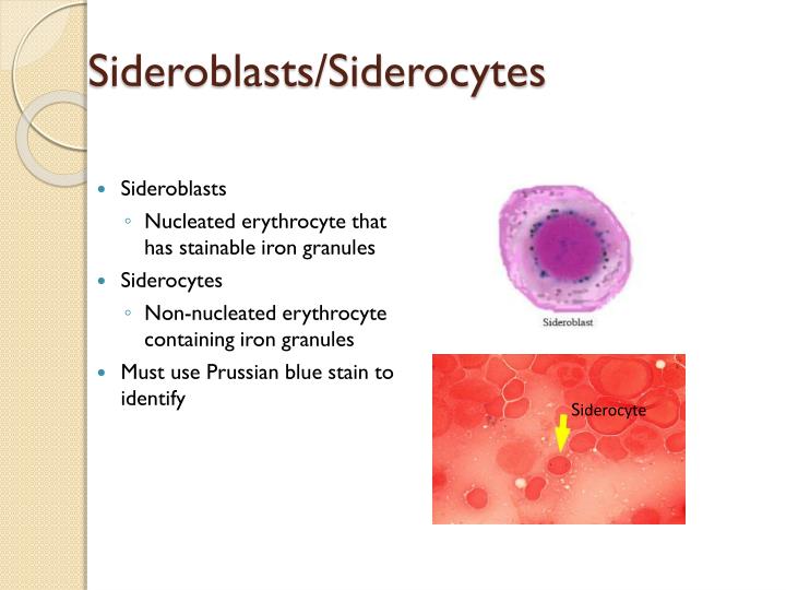 PPT - MLAB 1415: Hematology Keri Brophy -Martinez PowerPoint ...