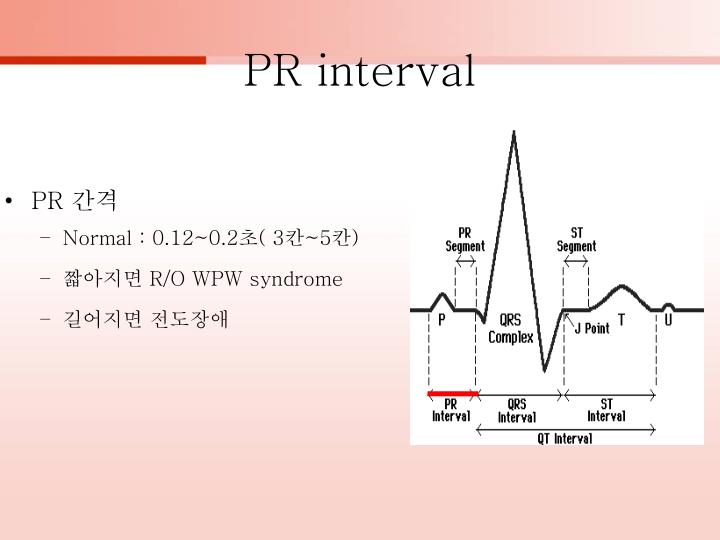 PPT - ECG (ElectroCardioGram) PowerPoint Presentation - ID:6319371