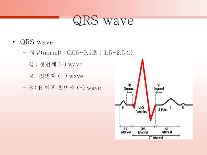 PPT - ECG (ElectroCardioGram) PowerPoint Presentation - ID:6319371