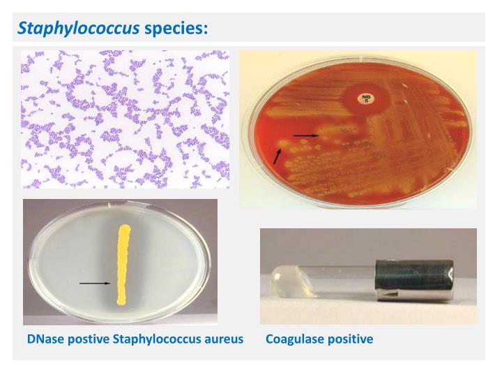 PPT - Bacteremia & septicemia PowerPoint Presentation - ID:6321505