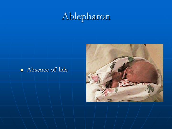 PPT - Congenital Eyelid Disorders PowerPoint Presentation - ID:6326593