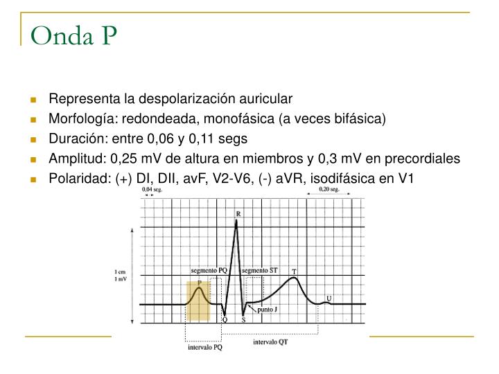 PPT - ECG normal PowerPoint Presentation - ID:6329506