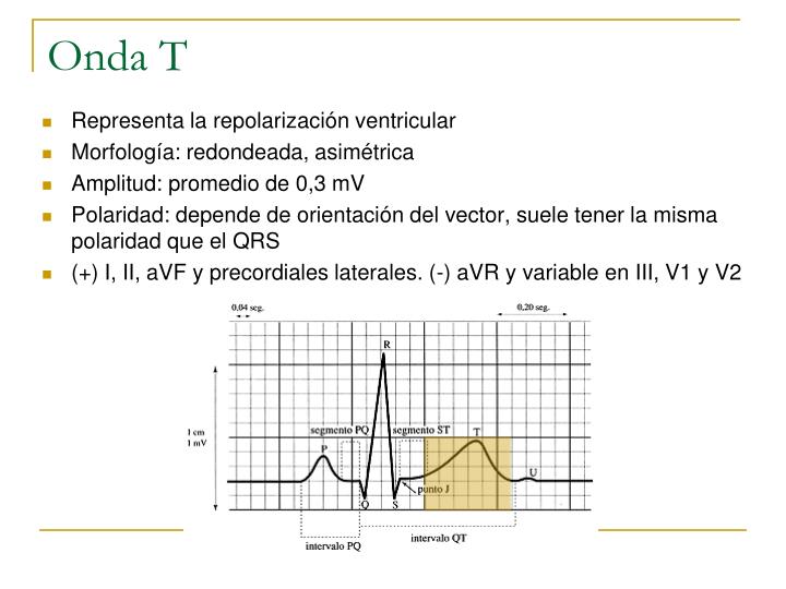 PPT - ECG normal PowerPoint Presentation - ID:6329506