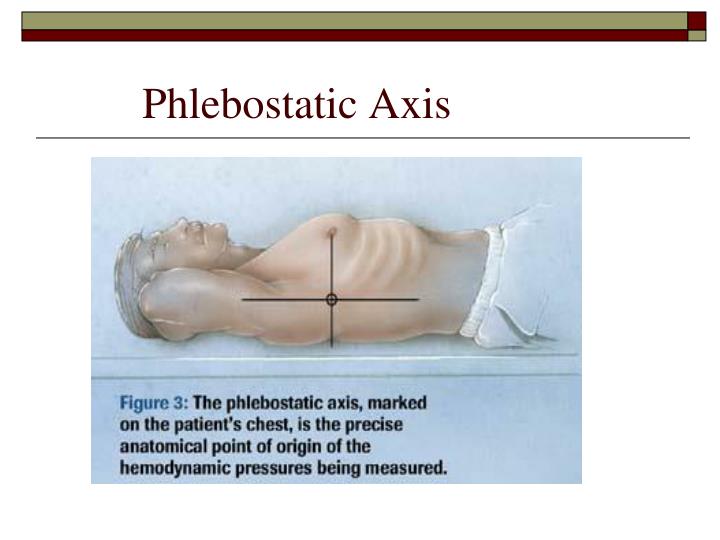 PPT - INVASIVE HEMODYNAMIC MONITORING PowerPoint Presentation - ID:6333249