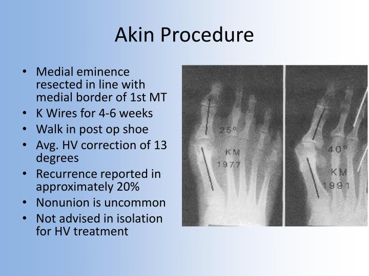 PPT - Hallux Valgus; the wrath of fancy shoes PowerPoint Presentation ...