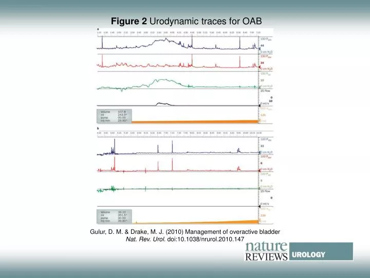PPT - Figure 2 Urodynamic traces for OAB PowerPoint Presentation, free ...