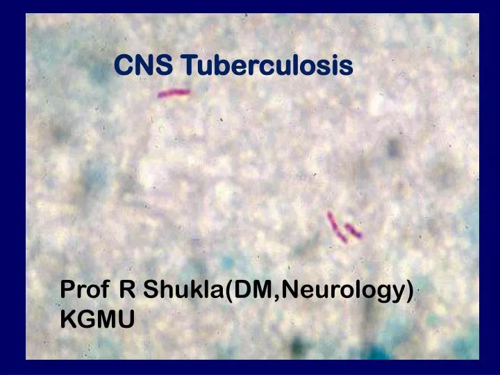 PPT - CNS Tuberculosis PowerPoint Presentation, free download - ID:6336519