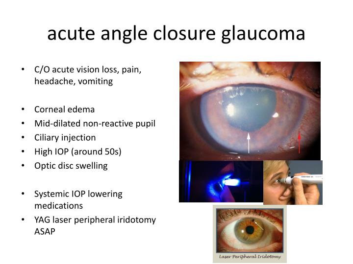 PPT - Acute and Chronic visual loss PowerPoint Presentation - ID:6336981