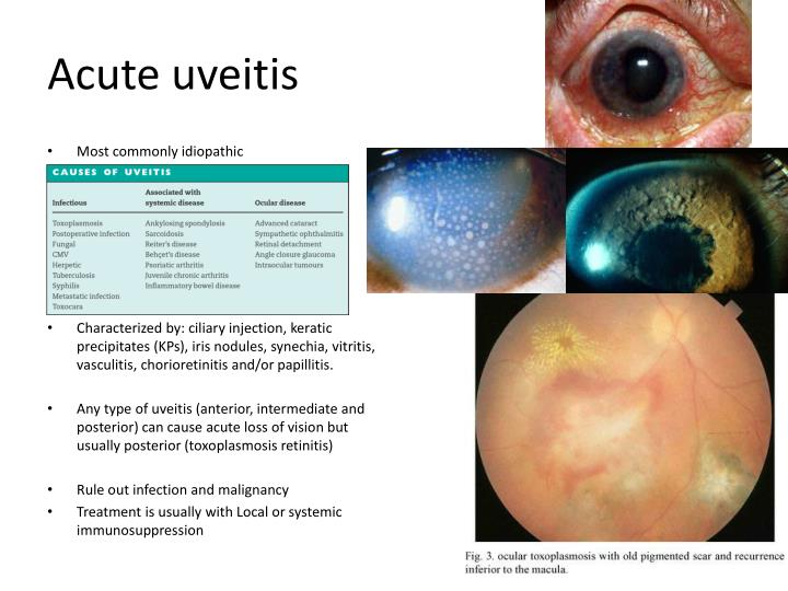 PPT - Acute and Chronic visual loss PowerPoint Presentation - ID:6336981