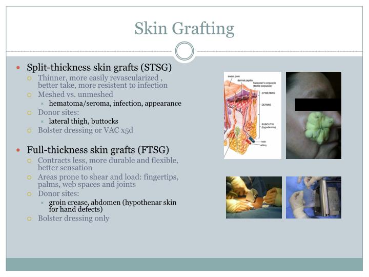 PPT - Degloving Injuries PowerPoint Presentation - ID:6337287