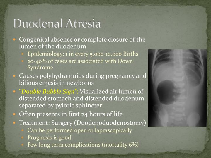 PPT - Neonatal Bilious Emesis PowerPoint Presentation - ID:6338342
