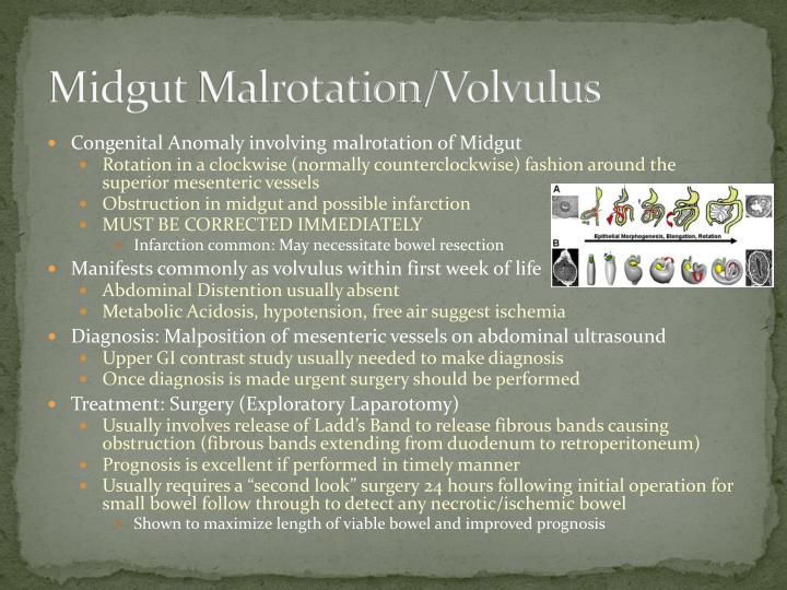 PPT - Neonatal Bilious Emesis PowerPoint Presentation - ID:6338342