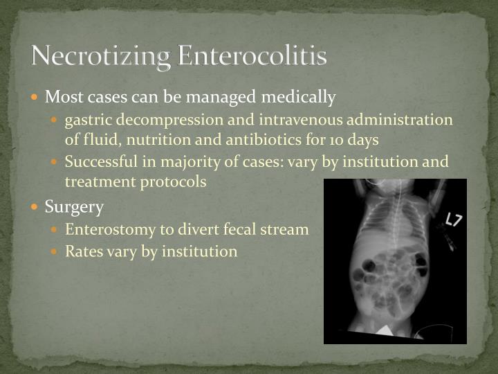 PPT - Neonatal Bilious Emesis PowerPoint Presentation - ID:6338342