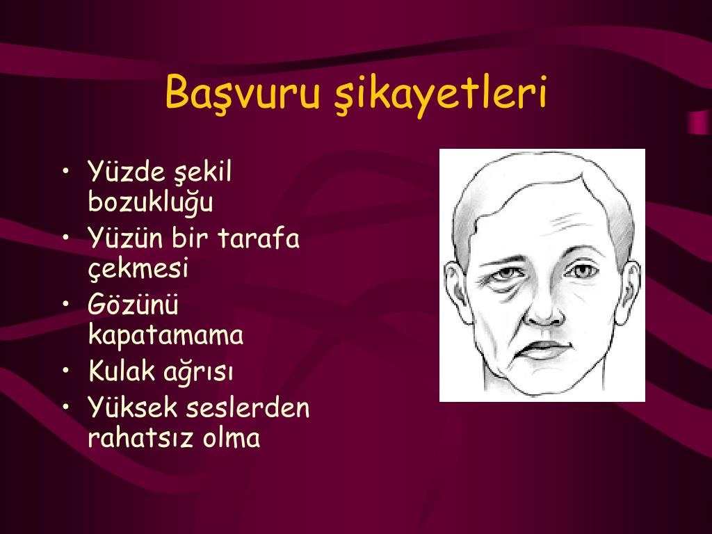 PPT - Fasiyal Sinir Paralizileri ne Güncel Yaklaşım PowerPoint ...