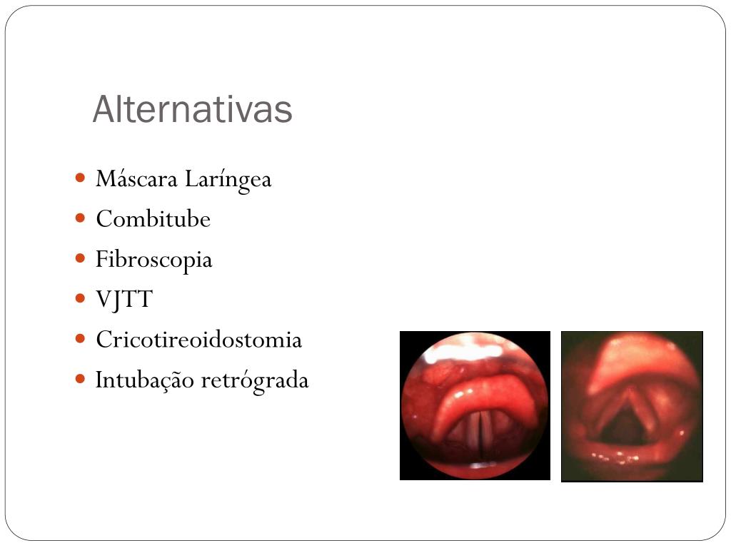 PPT - INTUBAÇÃO ENDOTRAQUEAL, VIA AÉREA DIFÍCIL, CRICOTIREOIDOSTOMIA E ...